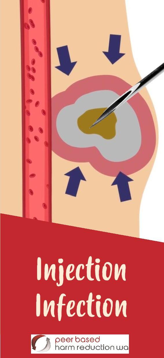 Printed Resources - Peer Based Harm Reduction WA